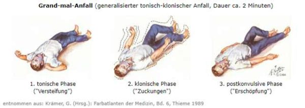 Das Deutsche Epilepsiemuseum | Deutschland mal anders